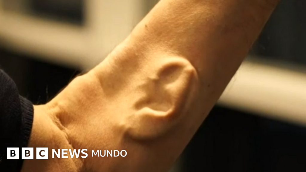 Una oreja implantada y cuernos en la cabeza: cómo son los "bodyhackers ...