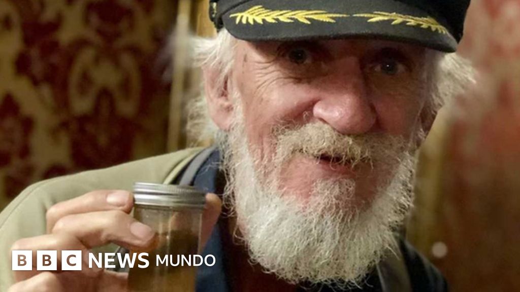 El británico que donó su dedo gordo del pie amputado a un bar en Canadá ...