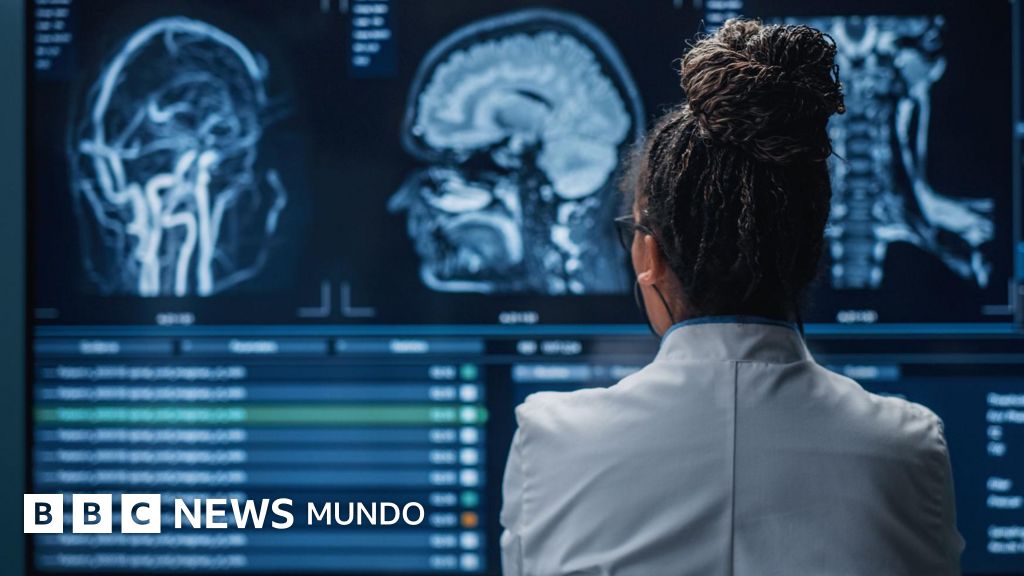 ¿Qué pasa en el cerebro cuando estamos muriendo?: lo que descubrió la ...