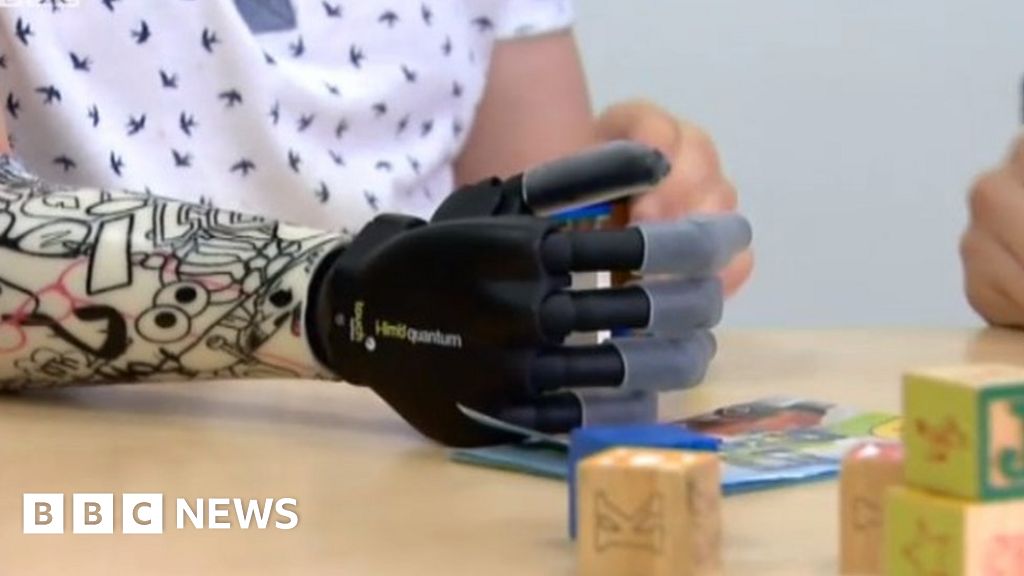 Touch Bionics opens new training centre in Germany - BBC News