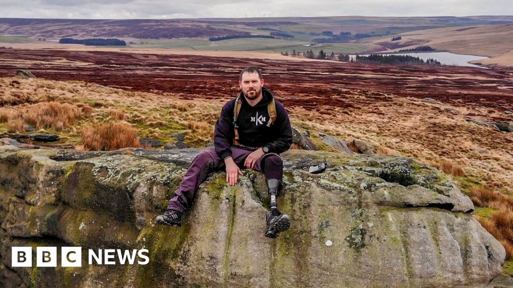 Amputee returns to Leeds major trauma centre