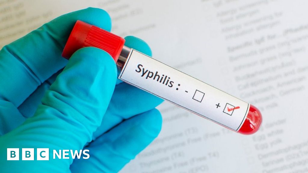 London has 60% of all syphilis cases in England - BBC News