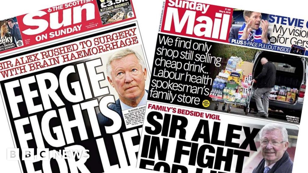 The papers: Fergie 'fights for life' after brain operation