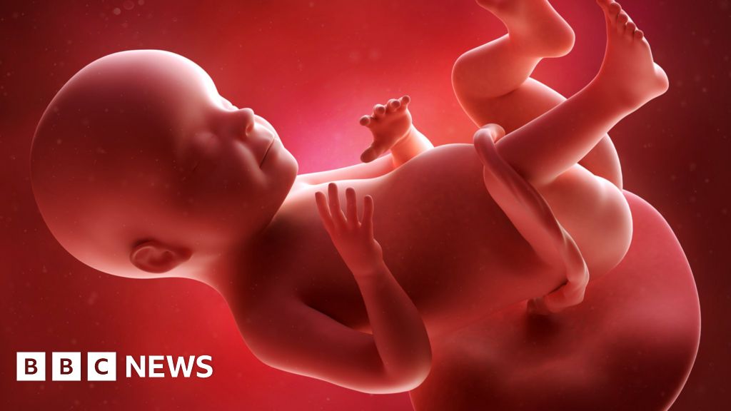 First 'in womb' stem cell trial to begin - BBC News