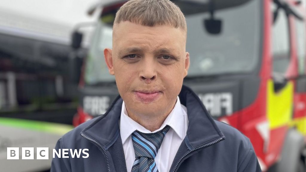 Burns victim's warning to teenagers on Bonfire weekend - BBC News