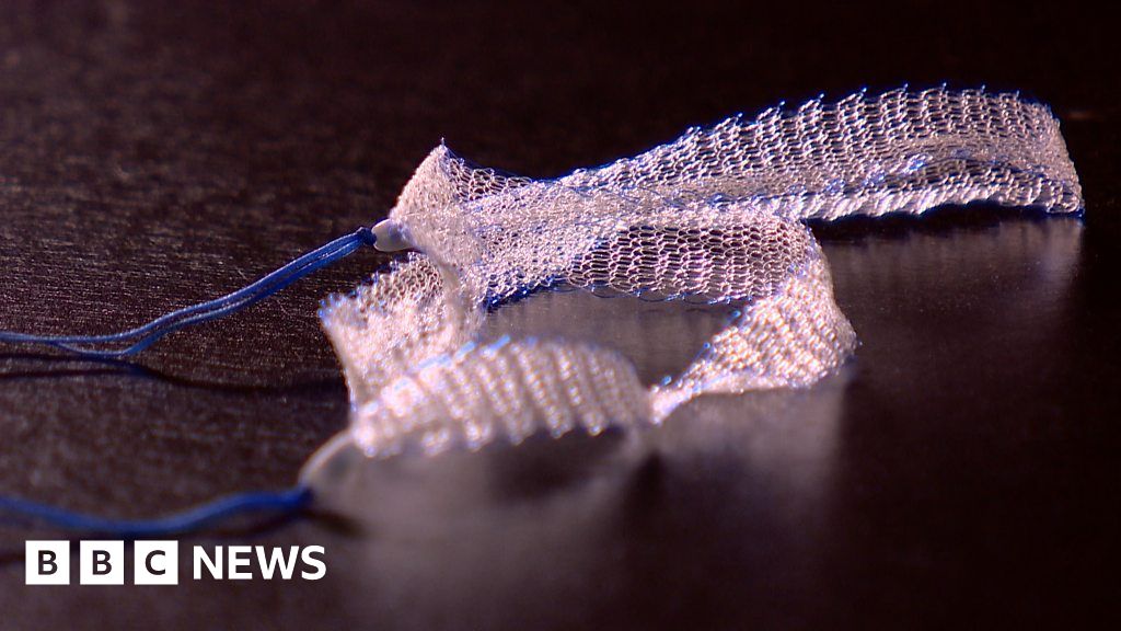 Woman warns of mesh implant complications - BBC News