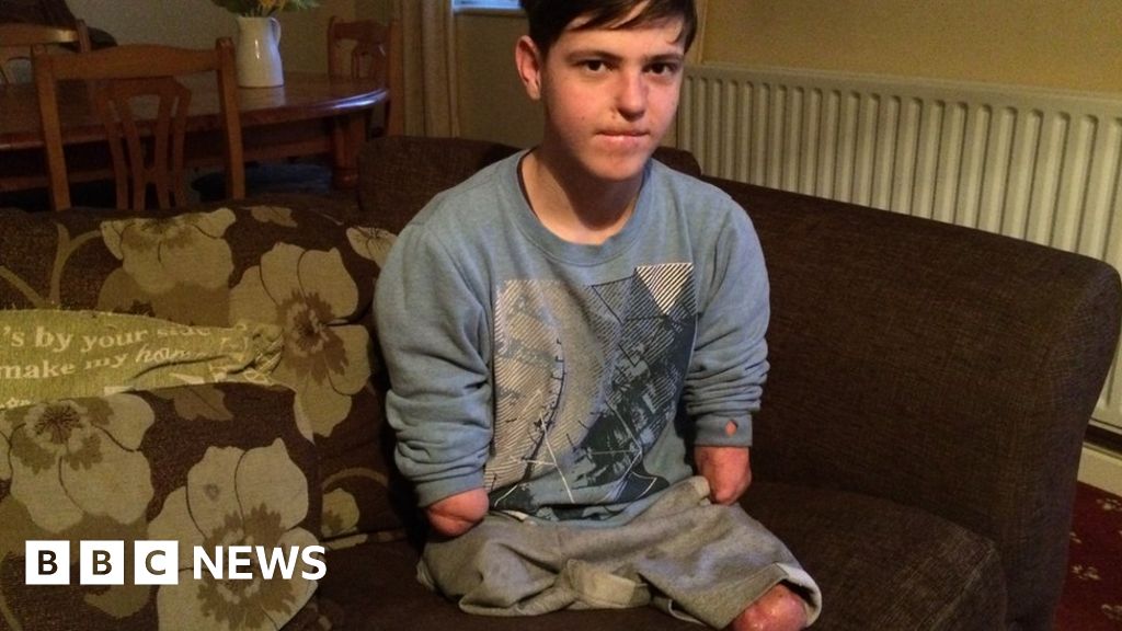 Meningitis limb loss boy told to prove disability - BBC News