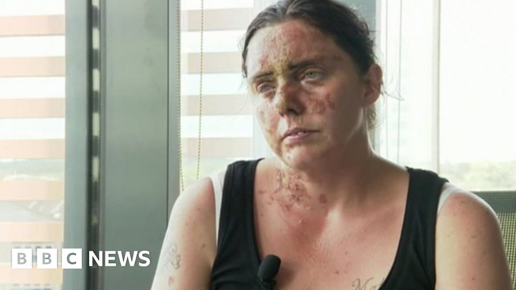 Three questioned over Southampton acid attack - BBC News