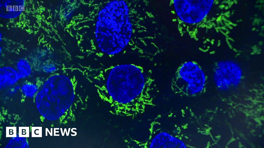 New microscope gives hope for cancer treatments