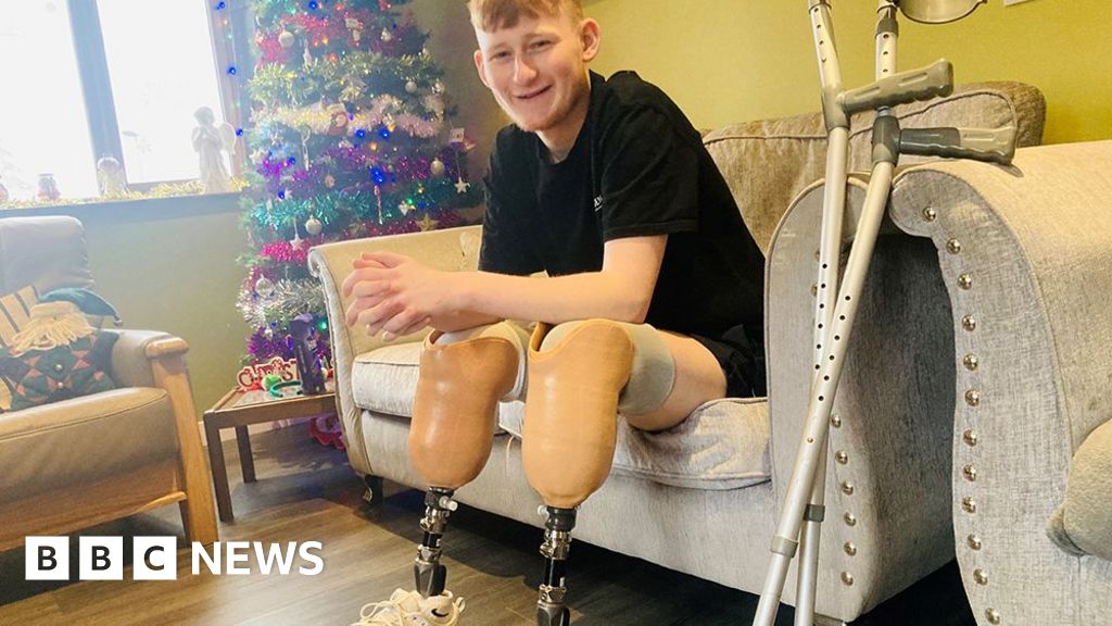 Macduff teenager adapting to life with prosthetic legs - BBC News