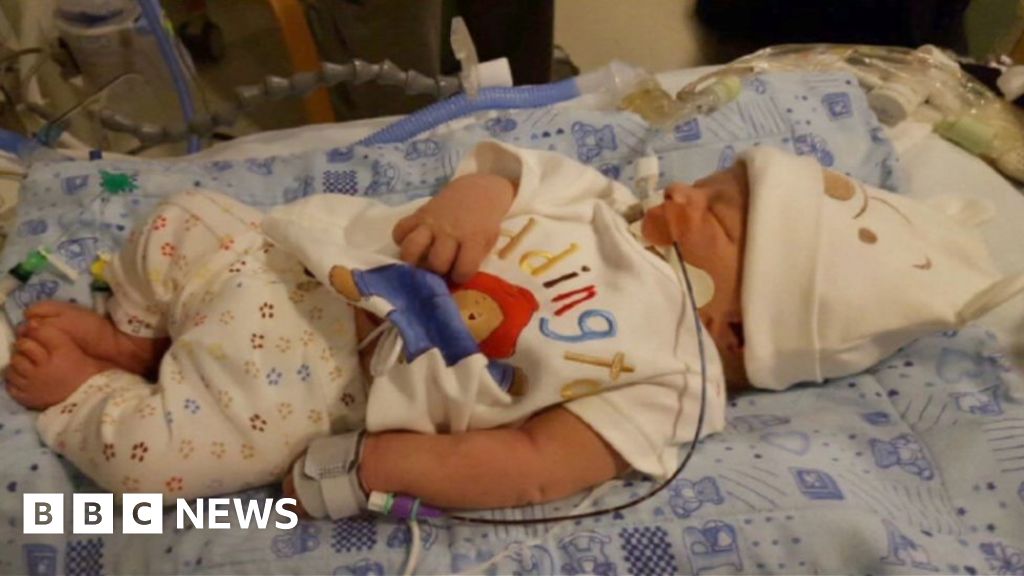 Addenbrooke's Hospital admits brain-damaged baby could have survived ...