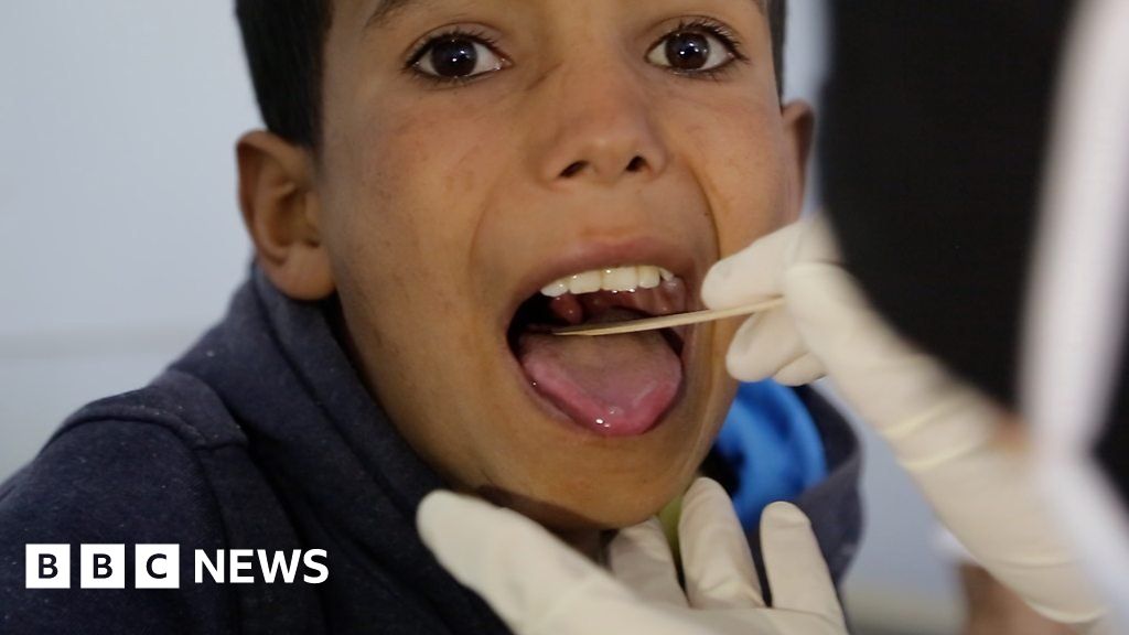 Yemen: Children hit by diphtheria outbreak - BBC News