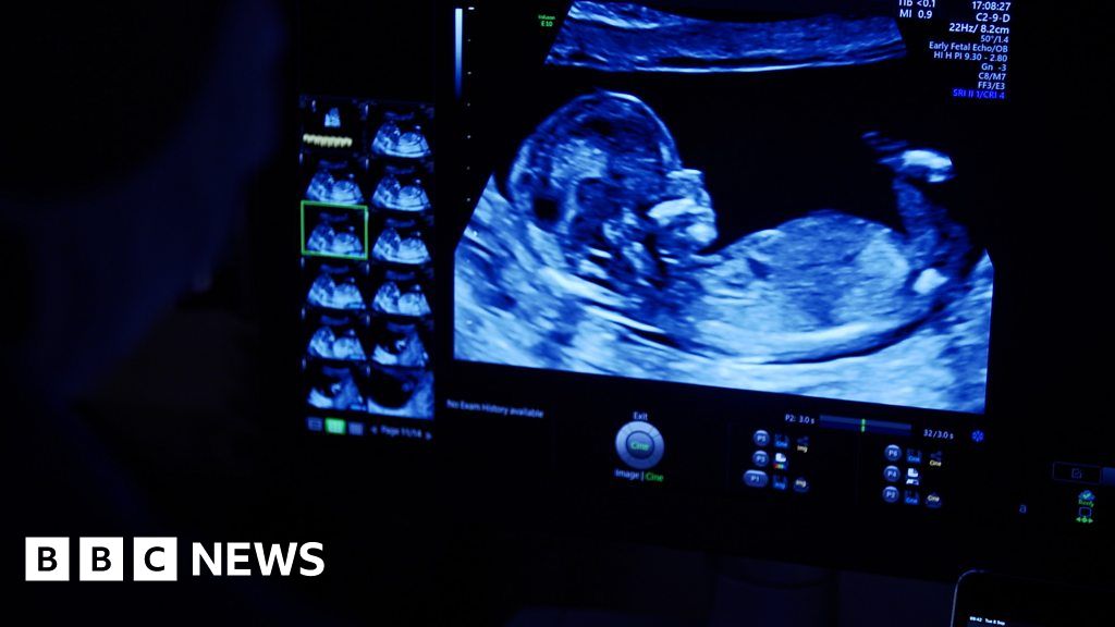 Private baby scan studios ‘a growing concern’ - BBC News
