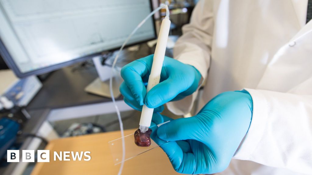 Pen Identifies Cancer In 10 Seconds