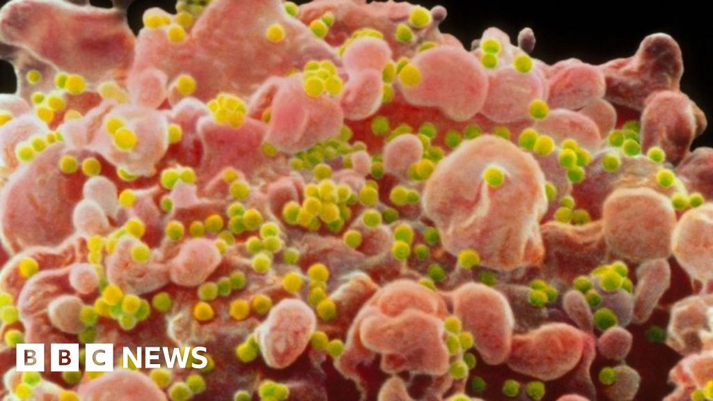 Man charged with infecting three women with HIV