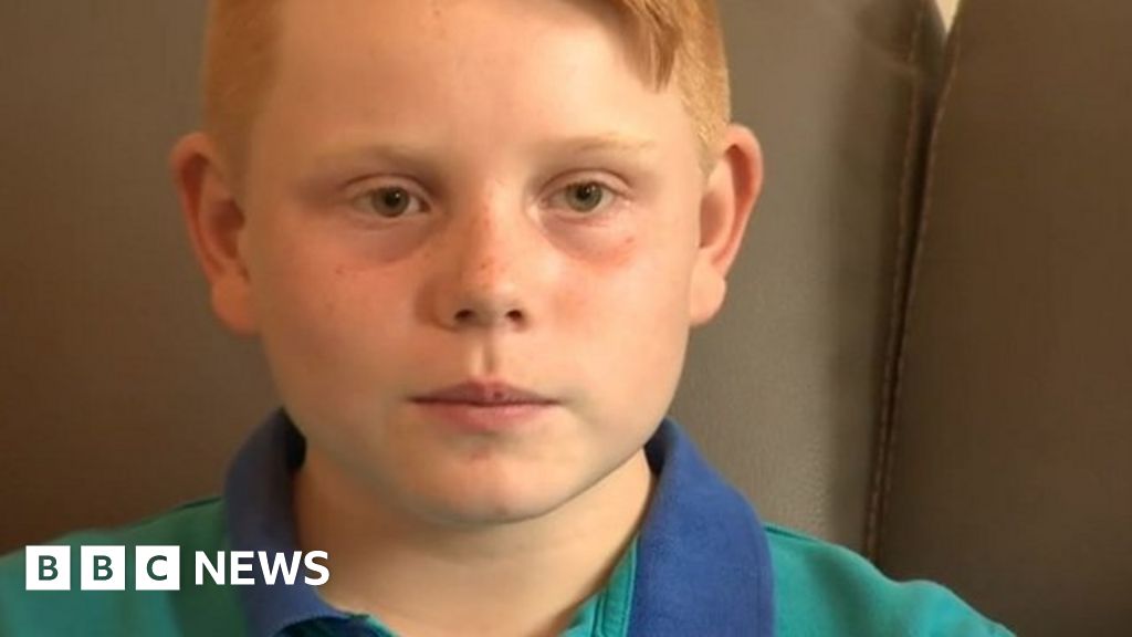 Boy 'stays strong' after he was attacked and film was posted on social ...
