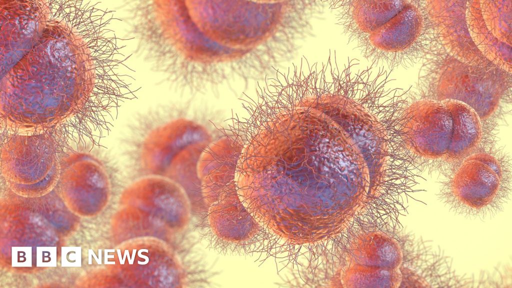 'Super-gonorrhoea' outbreak in Leeds - BBC News