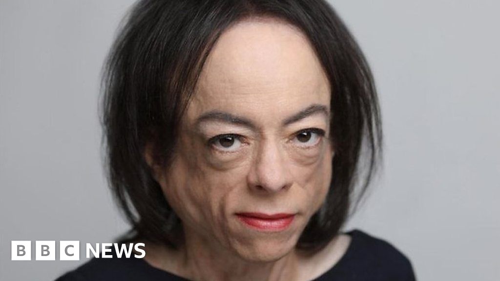 Liz Carr: Silent Witness star reveals film role