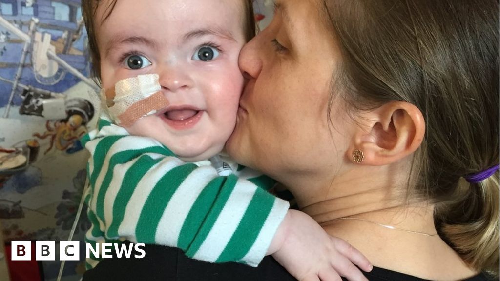 Critically-ill children 'need more aftercare'