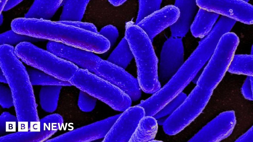 Charnwood E. coli deaths 'likely to be environmental'