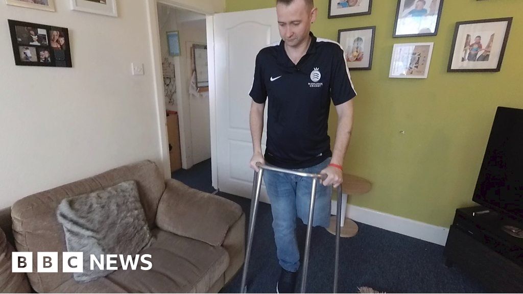 Crowdfunded amputee 'never been happier' - BBC News
