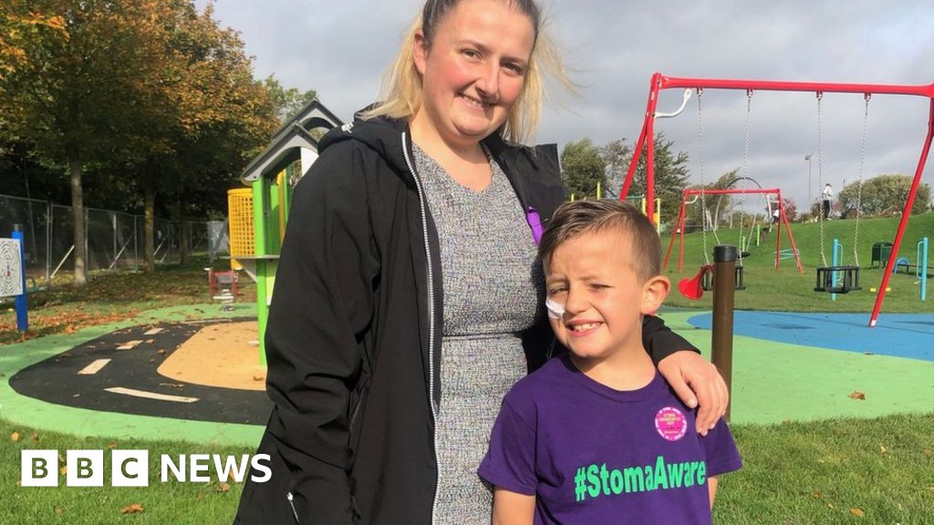 Shotton Colliery boy with stoma completes running challenge