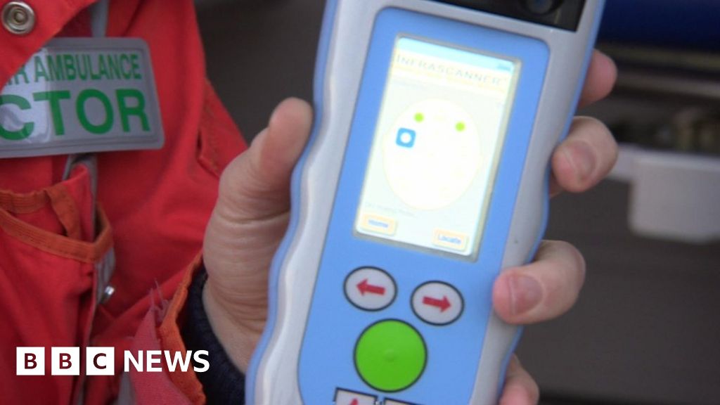 Portable brain scanner trialled by London's Air Ambulance - BBC News