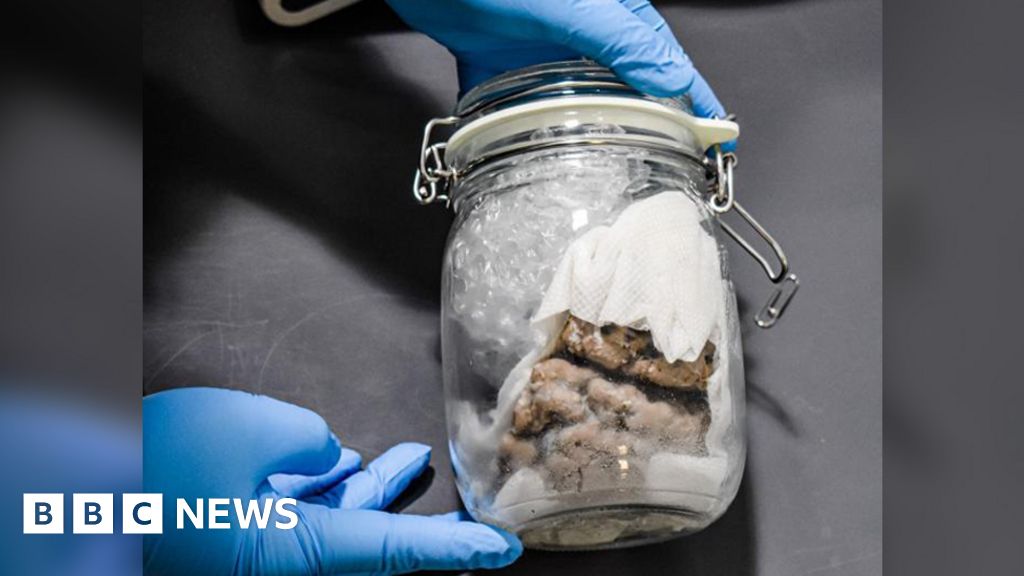 Human brain seized in mail truck on US-Canada border