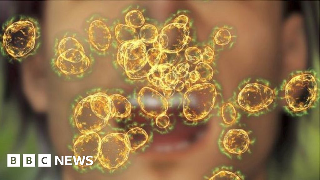 Bird flu case confirmed in Republic of Ireland - BBC News