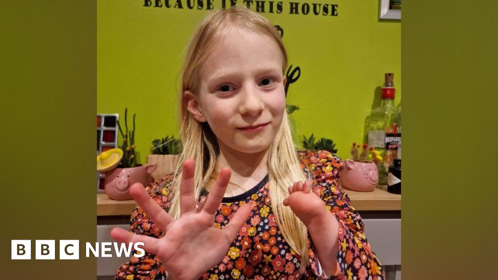 Symbrachydactyly: Wymondham girl to return to school with bionic arm ...