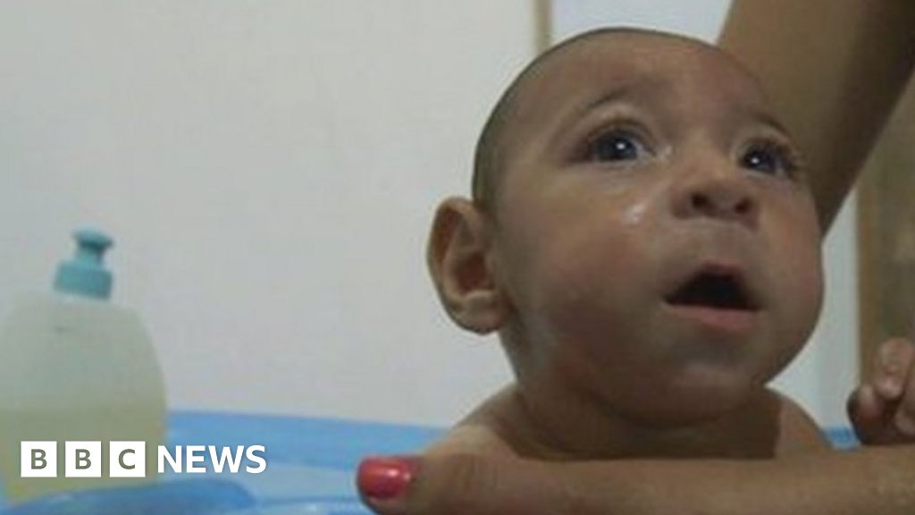 'I looked at him and a normal child and could see his head was smaller ...