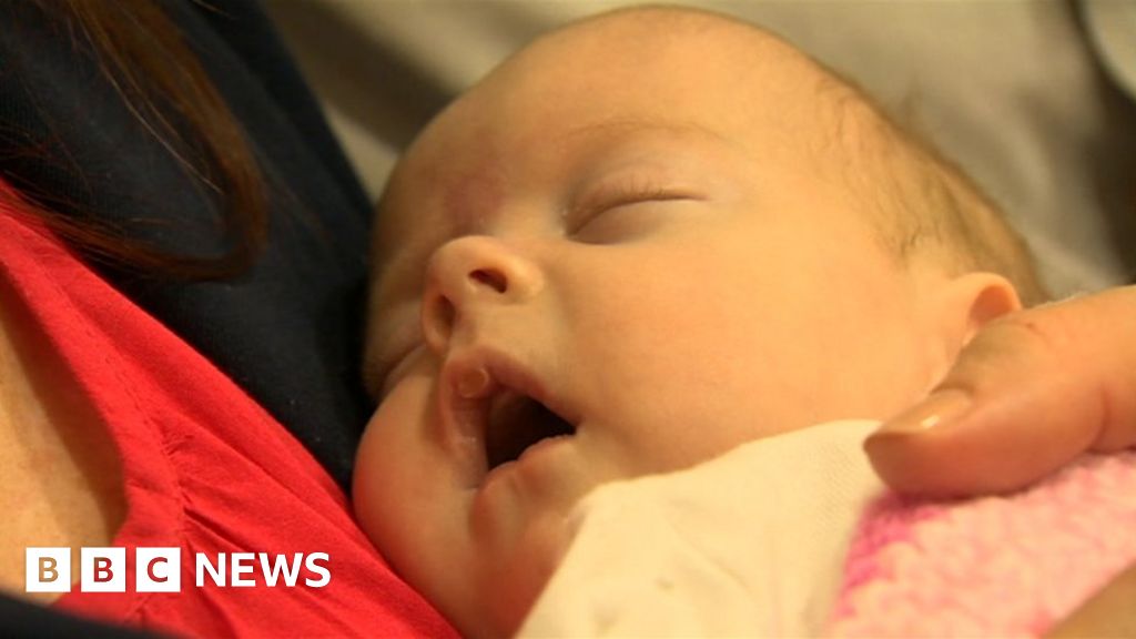 Baby born four months early survives surgery at Tooting hospital - BBC News