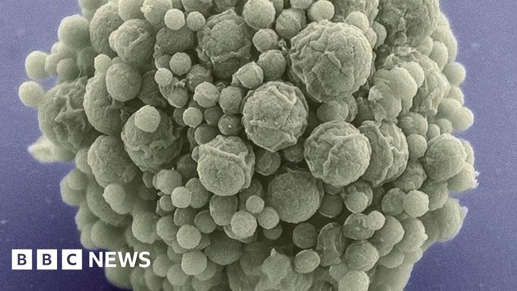 Synthetic bug given 'fewest genes' - BBC News