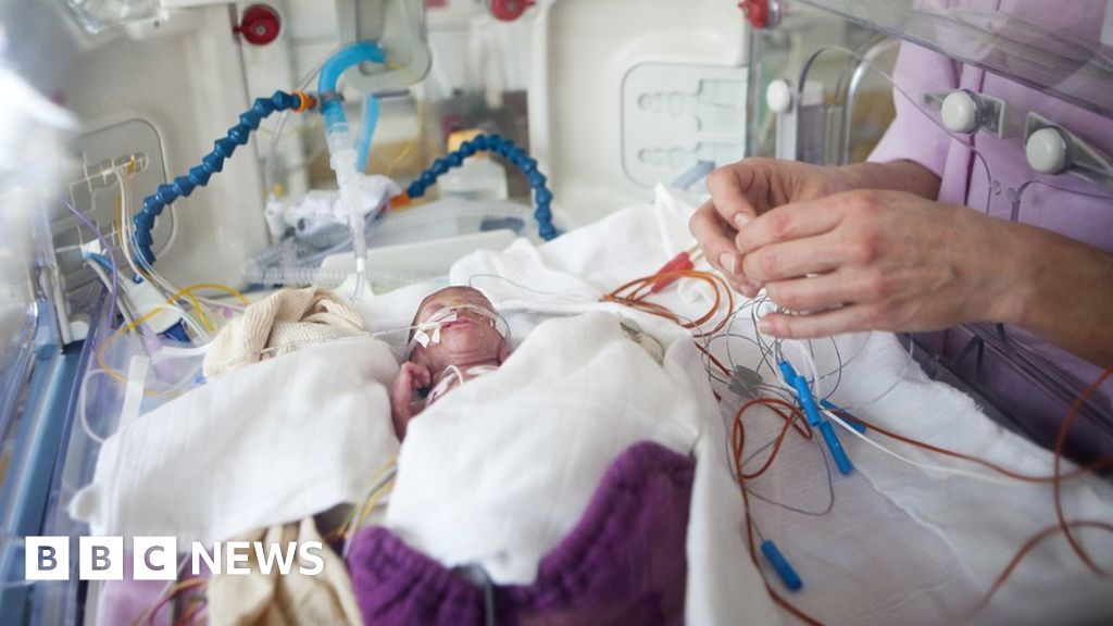 Outlook for extremely premature babies 'improving' - BBC News