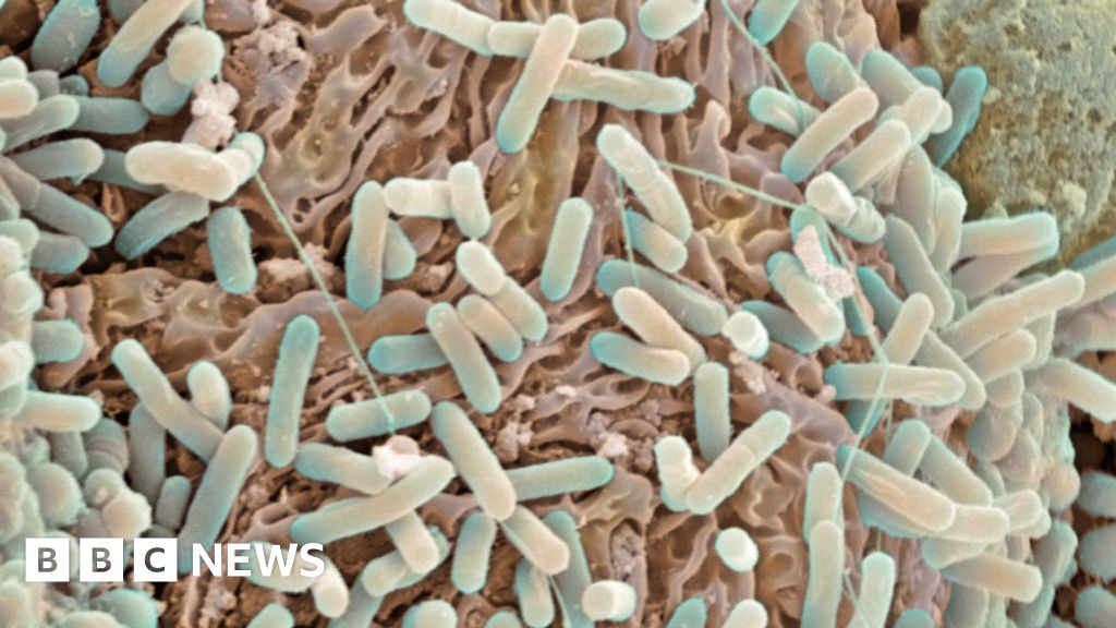E. coli outbreak which led to child's death declared over - BBC News