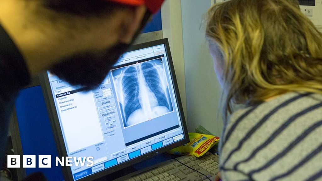 'Outdated' IT leaves NHS staff with 15 different computer logins