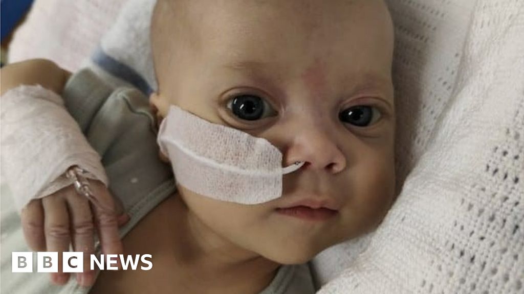 Parents make urgent appeal for liver donor to save baby girl