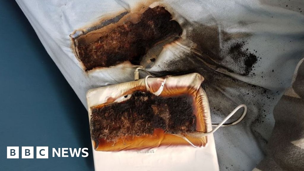 Boy's Samsung tablet overheats and burns bed