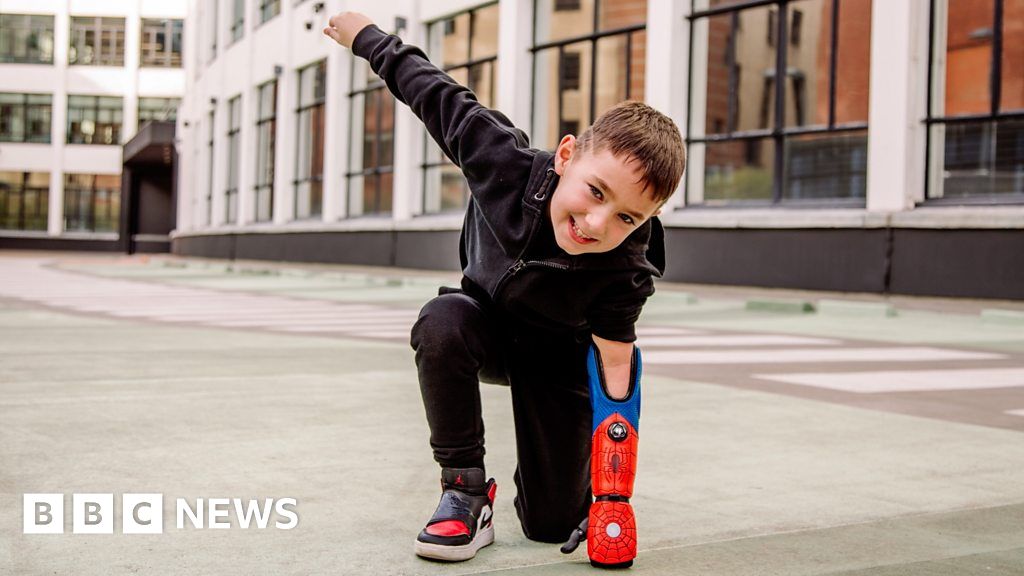 Eight-year-old boy born with one hand gets Spider-Man bionic arm - BBC News