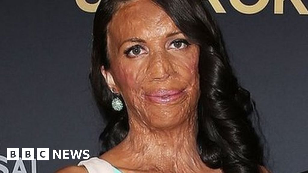 Australian burns survivor Turia Pitt completes triathlon - BBC News