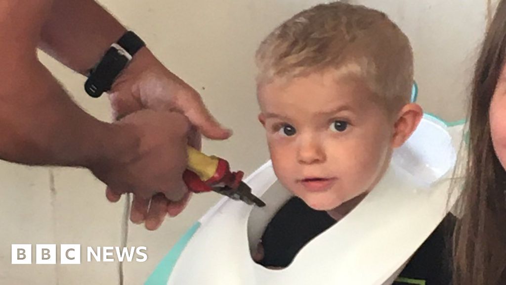 Bristol toddler gets head stuck in toilet seat - BBC News