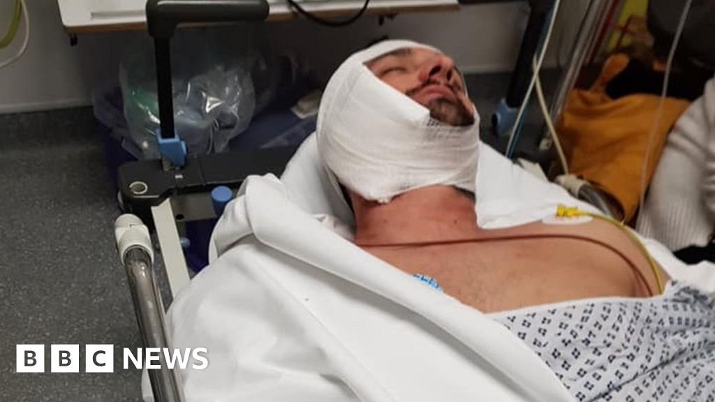 Clacton man's face slashed with belt in bar toilet