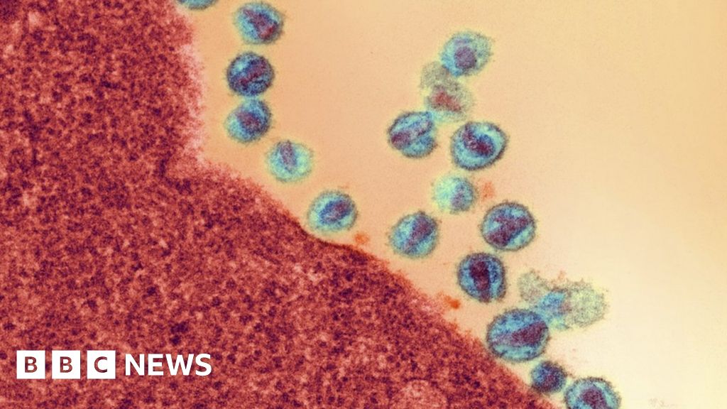 HIV flushed out by cancer drug - BBC News