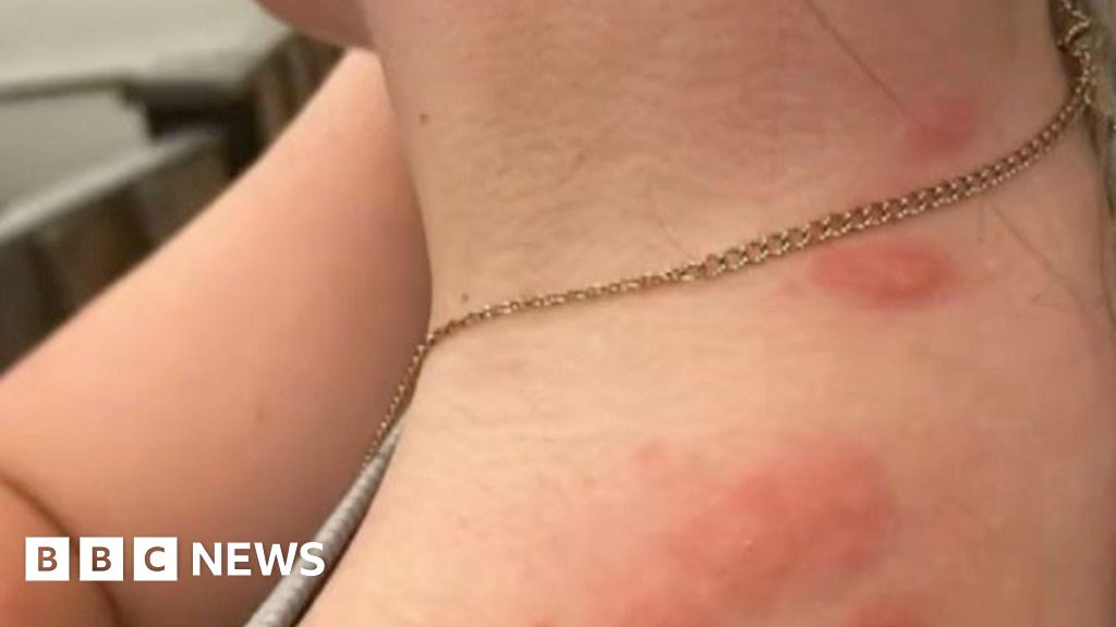 Butlin's trip cut short due to suspected bed bugs - BBC News