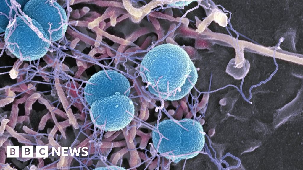 Meningitis: Why you need to know about it if you're heading to university - BBC News