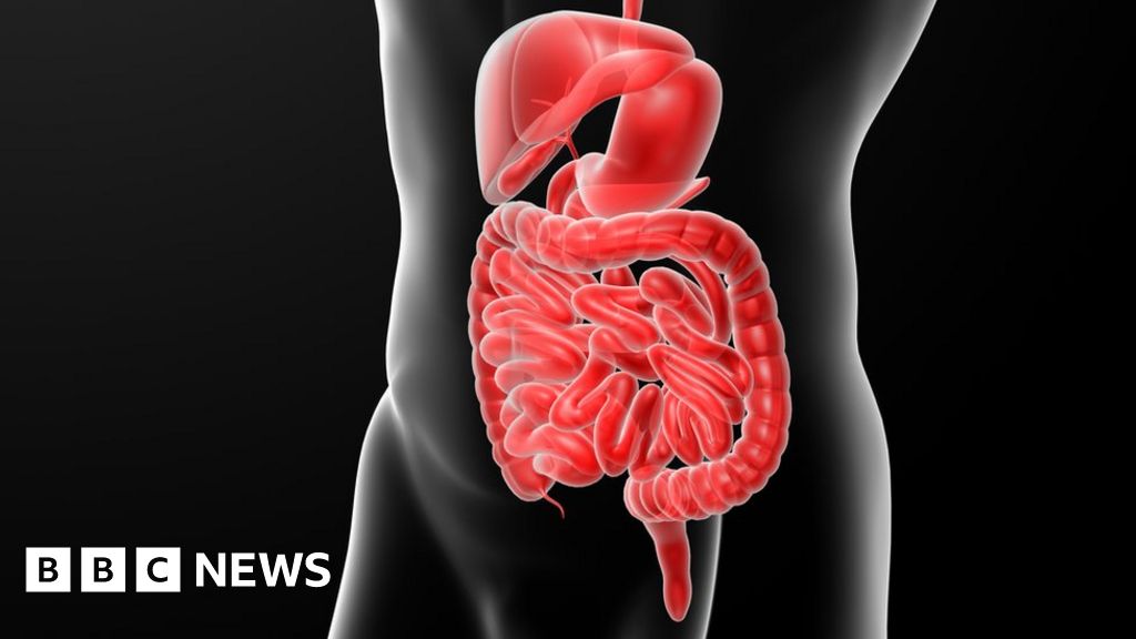 Bowel disease patients in lifestyle study - BBC News