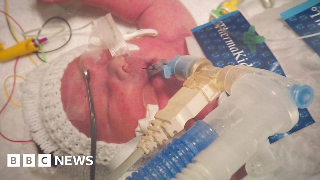 Parents' anger at baby deaths NHS trust - BBC News