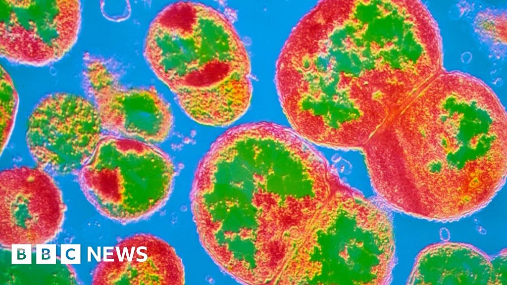 Australia gonorrhoea cases surge 63%