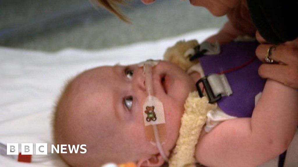Baby born with heart outside body set to return home