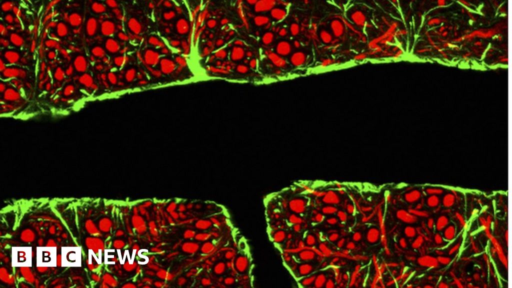 Scientists breach brain barrier to treat sick patient - BBC News